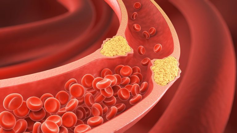 Cholesterol 101: HDL, LDL, and Triglycerides Explained